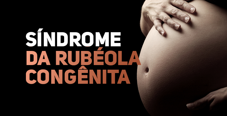 Síndrome da Rubéola Congênita - DIVE