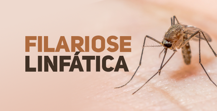 Filariose Linfática - DIVE